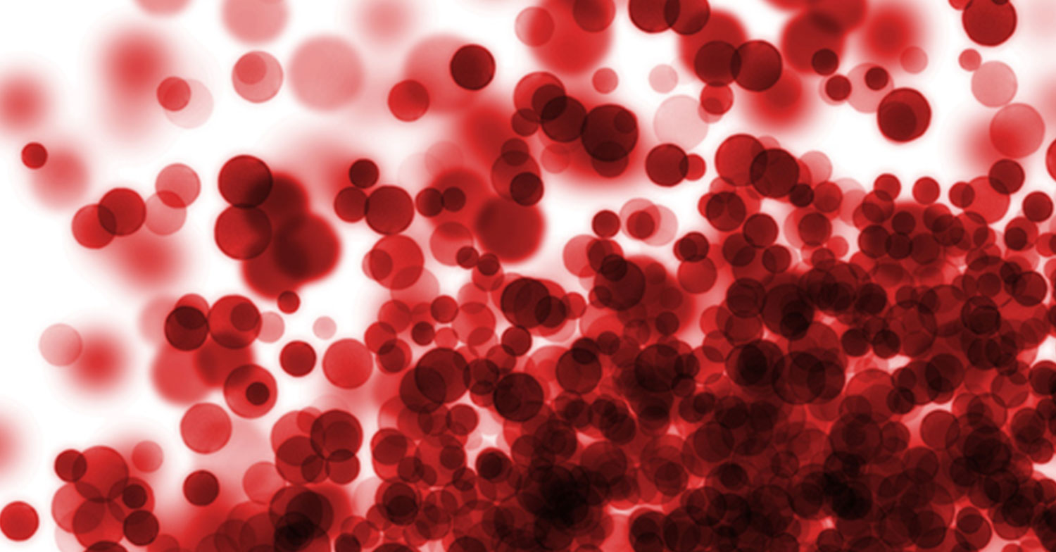 Neoplasie mieloidi, verso una semplice analisi genetica per la diagnosi ...